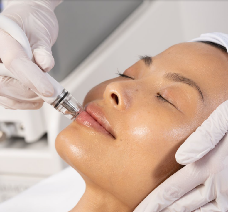 DiamondGlow® Facial in Akron, OH | Summit MedAesthetics